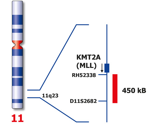KMT2A (11q23) - ISH Probes - Molecular Pathology
