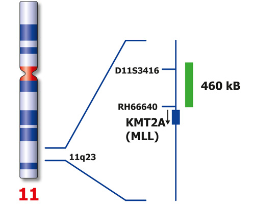KMT2A (11q23) - ISH Probes - Molecular Pathology