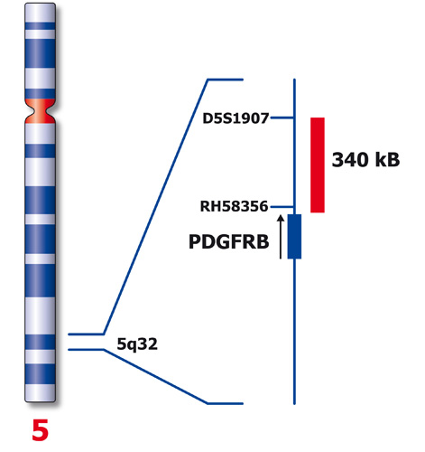 PDGFRB (5q32) - ISH Probes - Molecular Pathology