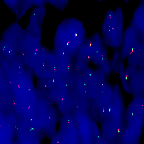 IVD BCL6 (3q27) Break - XL for BOND - ISH Probes - Molecular Pathology