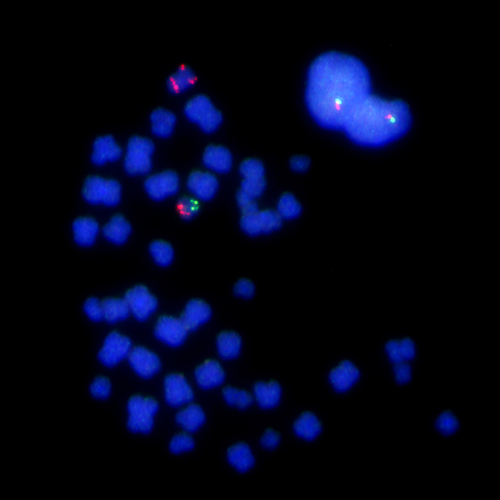 TP53 (17p13) / MPO (17q22) ISO 17q - Products