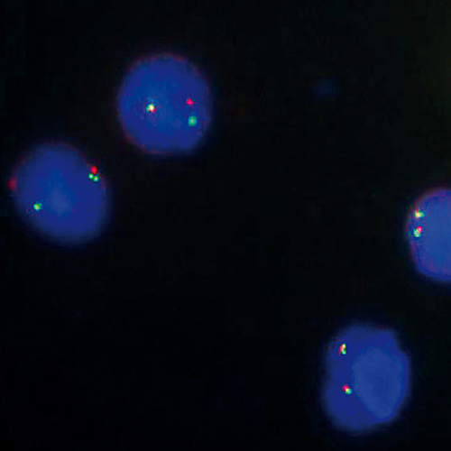 IVD BCL6 Break - ISH Probes - Molecular Pathology