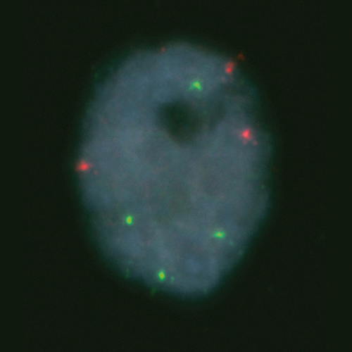 IVD 15q22/6q21 - ISH Probes - Molecular Pathology